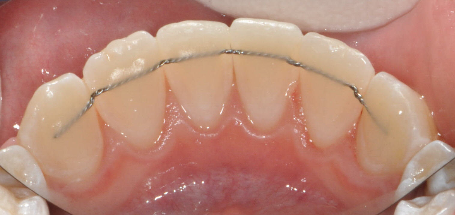 Retainer Anpassung 1020 Wien | DDr. Karl Maurer